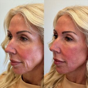 St. George Med Spa | Aesthetician St. George | MaVie Med Spa