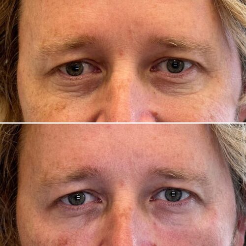 St. George Med Spa | Aesthetician St. George | MaVie Med Spa